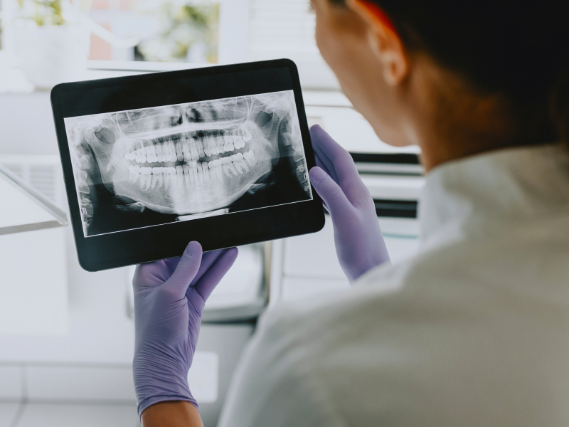 Are Digital or Traditional X-Rays Best for Dental Patients?